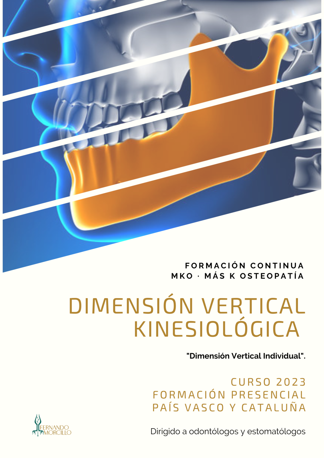 DIMENSIÓN VERTICAL KINESIOLÓGICA INDIVIDUAL – Fernando Morcillo